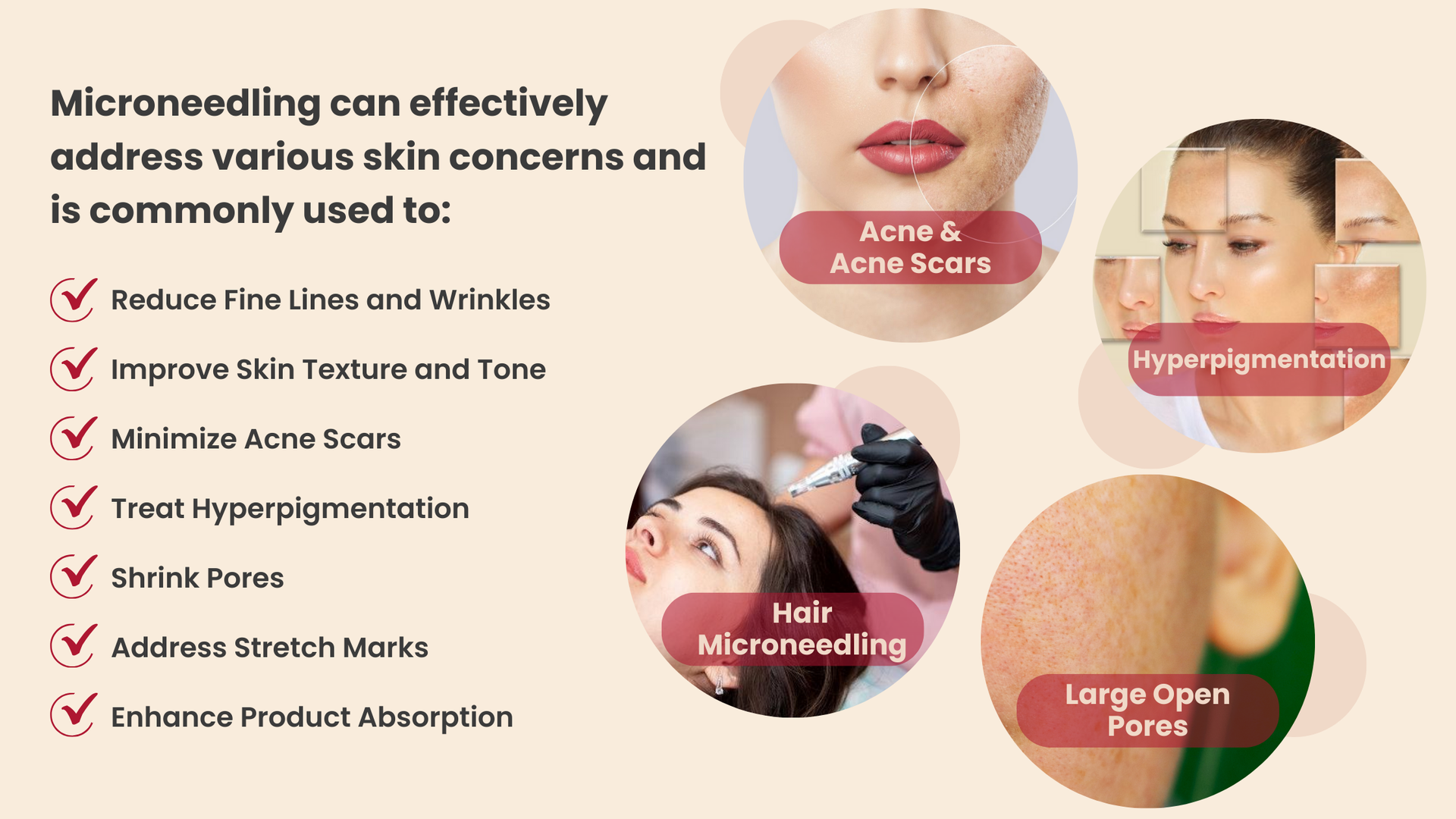 Microneedling Treatment Cases - CBAM